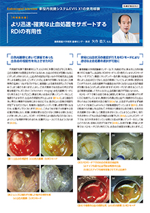 より迅速・確実な止血処置をサポートするRDIの有用性|動画・レポート|オリンパス医療ウェブサイト メディカルタウン